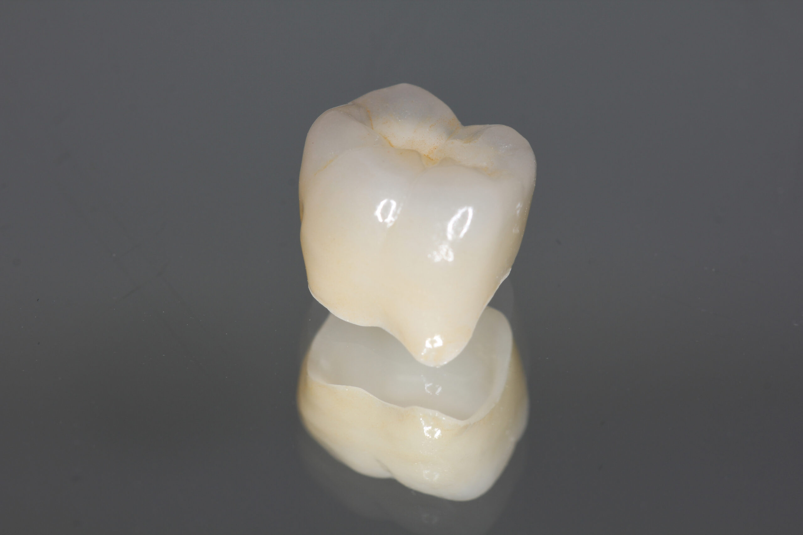 Capping Teeth With Lifelike Crowns | Brighton, MA