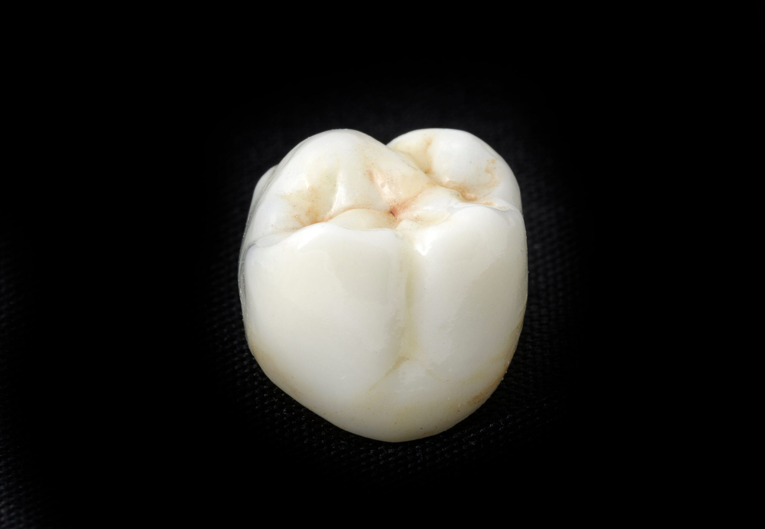 Helping Your Smile With All-Porcelain Crowns | Brighton, MA