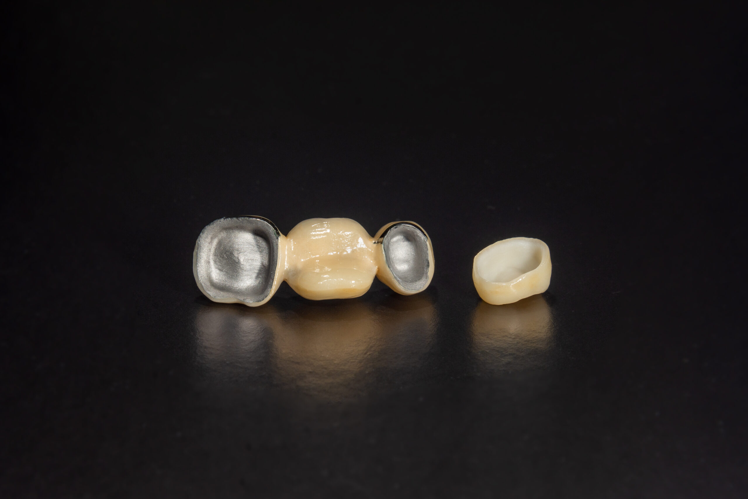 How We Fit Your Teeth With Custom Crowns | Brighton, MA