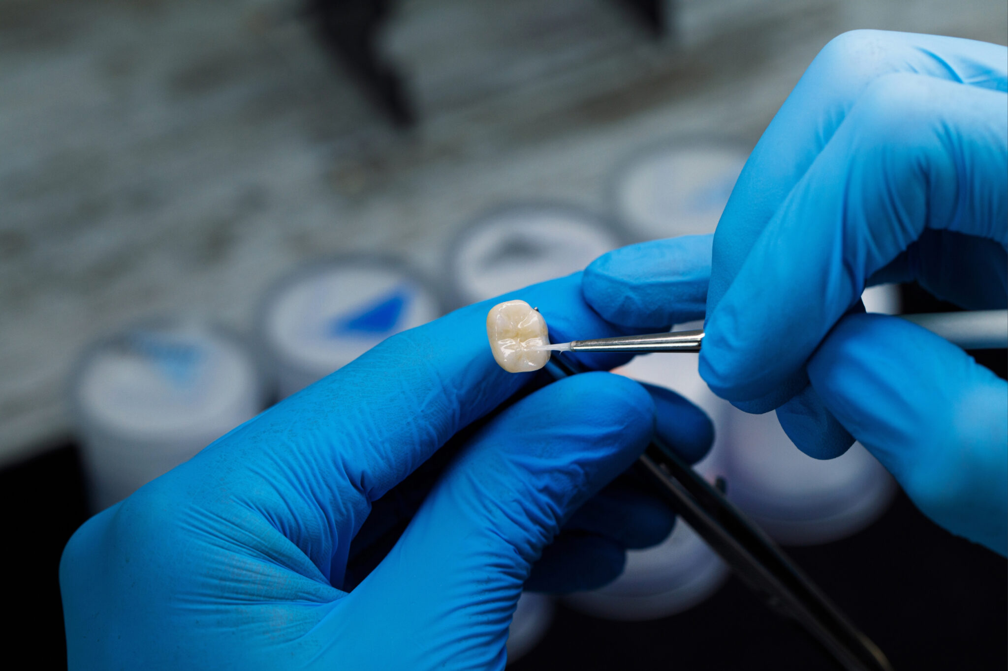 Lifelike Repair With Our Dental Crowns | Brighton, MA